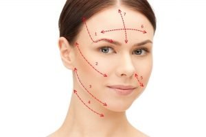 Fadenlifting Düsseldorf | Kosten & Ablauf | Dr. Henscheid